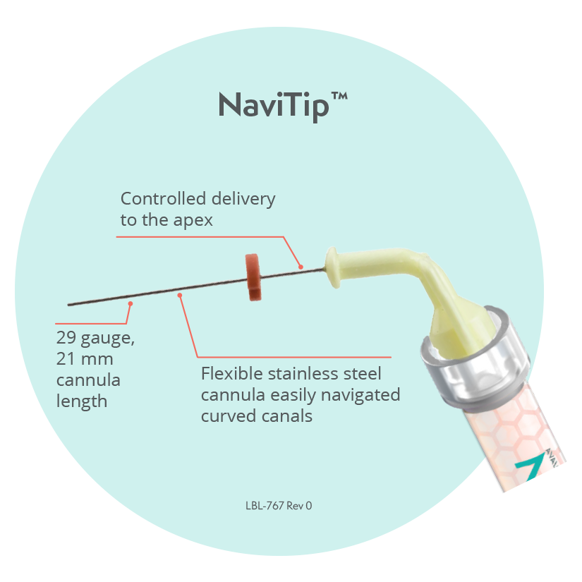 NeoSEALER EZFlo Mini Kit (0.5 g syringe + 4 NaviTips)